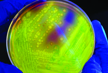 Fidaxomicin Curbs Return C. difficile In Real-World Setting