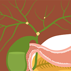 Carcinoma Carcinoma - Wikipedia