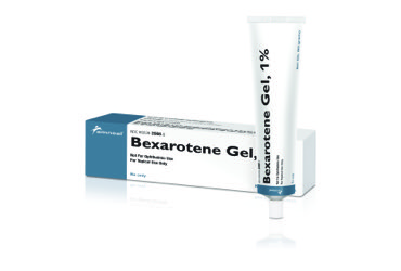 Amneal Launches Bexarotene Gel, 1%