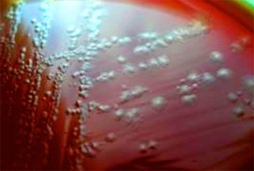 Dificid Logo Clostridium Difficile Infection Treatment Market And