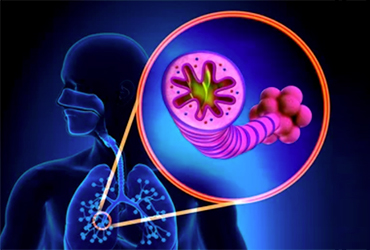 FDA Approves Breyna, First Generic of Symbicort to Treat Asthma and COPD