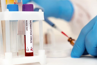 Labcorp Begins Monkeypox Testing