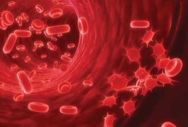 Understanding a Rare Disease: Essential Thrombocytosis