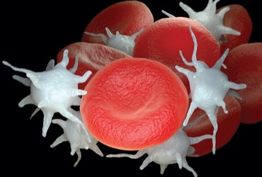 Understanding a Rare Disease: Essential Thrombocytosis