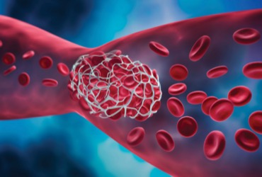 DOAC Prescribing Support Tool