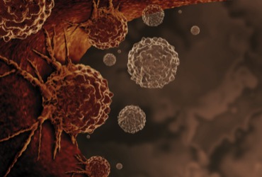 Glucarpidase Boosts Recovery From Methotrexate-Induced AKI