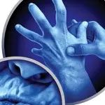 ISMP Updates Often Confused Drug Names List